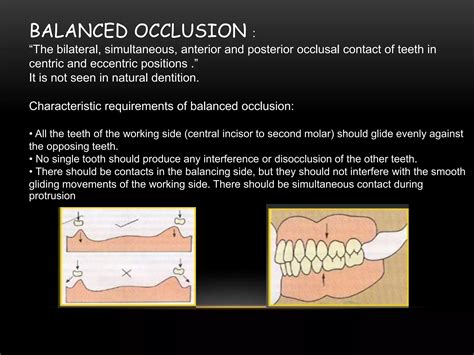 Occlusal Adjustments In Cd Pptx