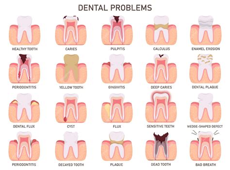 Premium Vector Teeth Medical Problems
