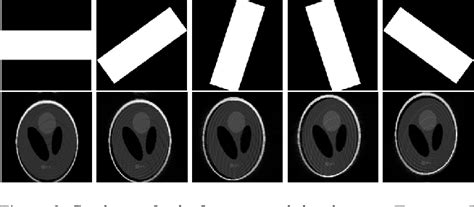 Figure 1 From Volumetric Reconstruction Resolves Off Resonance Artifacts In Static And Dynamic
