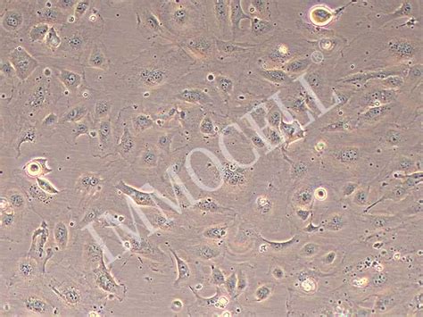 Hrmec 人视网膜微血管内皮细胞 逸漠细胞库