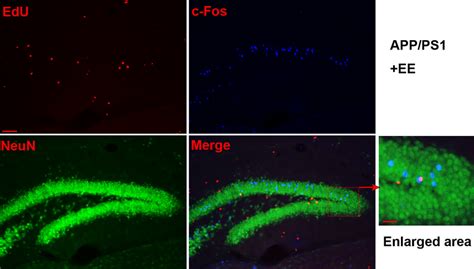 C‐fos Expression In Newborn Neurons In The Dg Area Of The App Ps1 Mice