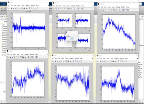 Figure 2 From Spatio Temporal Convolutional Neural Networks Based Brain