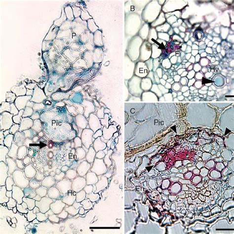 Transverse Sections Of The Red Clover Root In Stage S2 The Sections Download Scientific Transverse Sections Of The Red Clover Root In Stage S2 The Sections Download Scientific