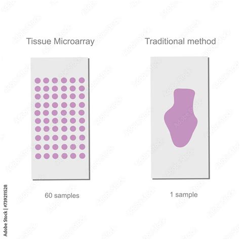 The Technique Comparison Between Traditional Method And Tissue