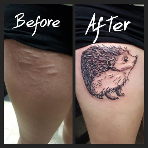 Can You Cover Scars With Tattoos Complete Guide 30 Pics Artistic