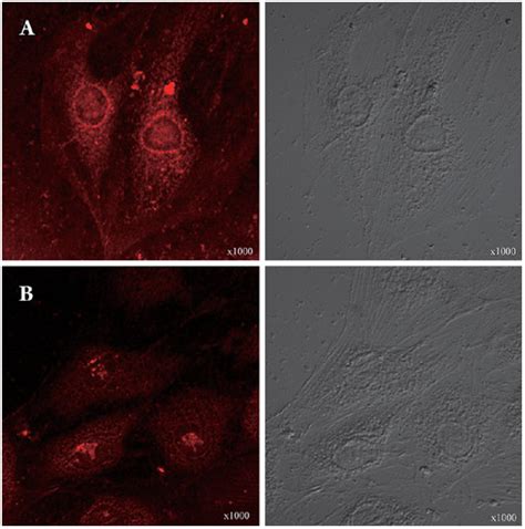 Fluorescent Immunolabeling Of Gst In H9c2 Cells With Marcaine A And