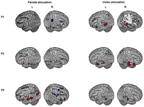 Individual Fmri Results Neural Effect Of Task Execution With Vs