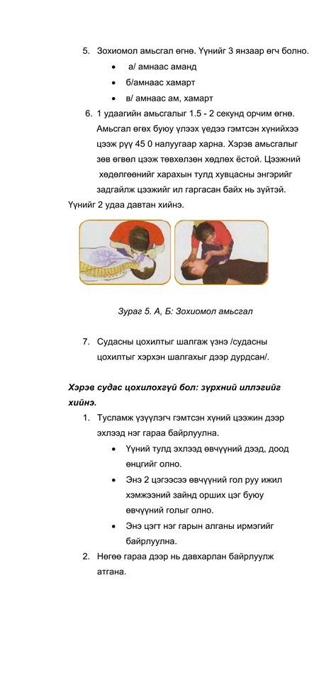 Осол гэмтлийн үед үзүүлэх анхны тусламж Pdf