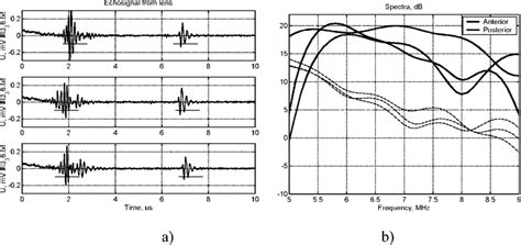 Waveforms Of Echo Signals Received From Anterior And Posterior Download Scientific Diagram