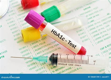 Hemoglobin A1c Test Stock Image Image Of Hospital Hormone 106681709