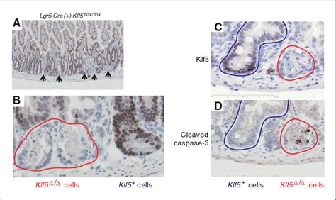 Figure 1 From Klf5 Regulates The Integrity And Oncogenicity Of Intestinal Stem Cells Semantic