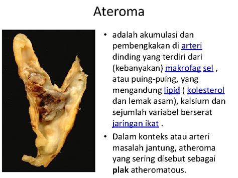 Lipids Lipid Adalah Kelompok Senyawa Heterogen Yang Berhubungan
