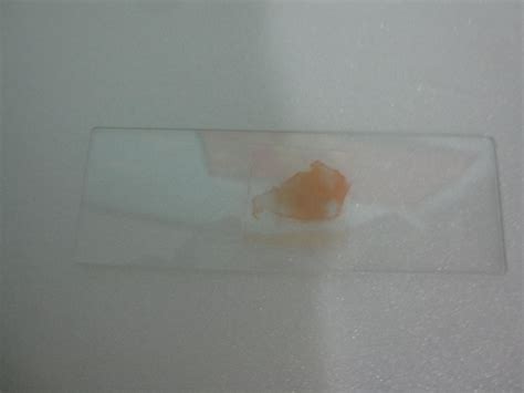 현미경 표본만들기 양파표피세포 And 구강상피세포 관찰 네이버 블로그