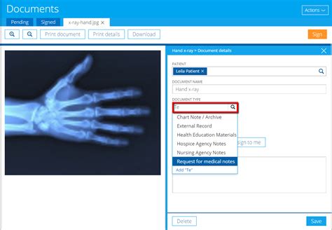 How Do I Create Custom Document Types