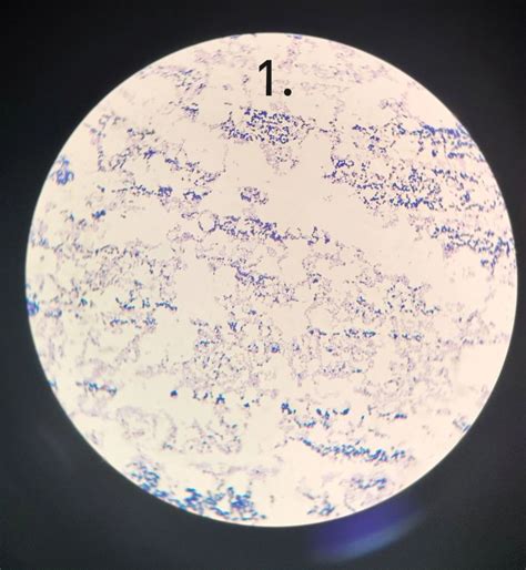 Picture 1 Streptococcus Pneumoniae 🦠 Picture 2 Streptococcus Agalactiae 🦠 Picture 3