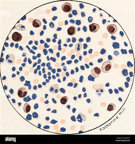 Poly Mononuclear Cells