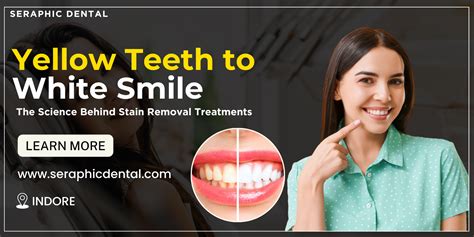 Yellow Teeth To White Smile The Science Behind Stain Removal