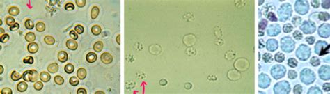 Urine Sediment Analysis And Interpretations FE Key Terms And Definitions Flashcards Quizlet