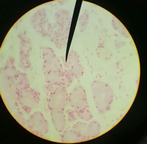 Identify Each Tissue Flashcards Quizlet
