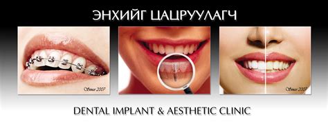 Facebook ХУУДАСНЫ ДЭЛГЭРЭНГҮЙ Энхийг Цацруулагч Шүдний Эмнэлэг