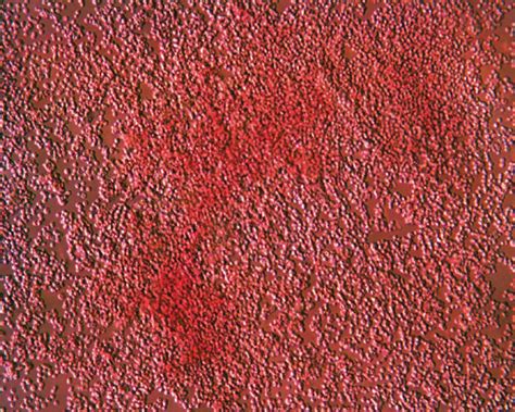 Erythroid Cells From Hescs After Prolonged Growth 1315 Days