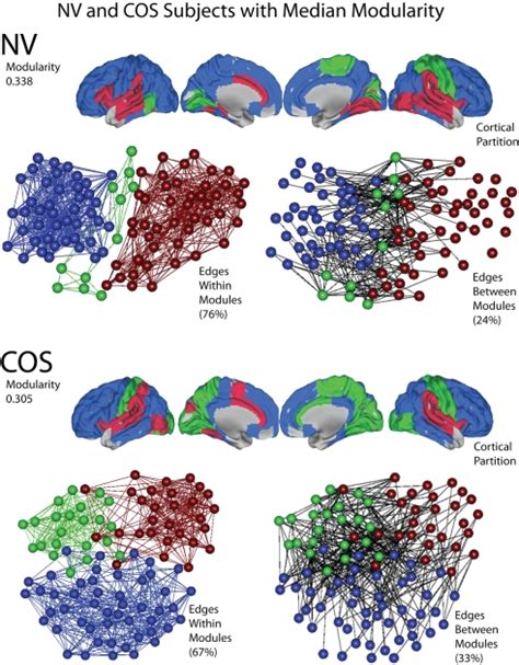 Brain Modularity
