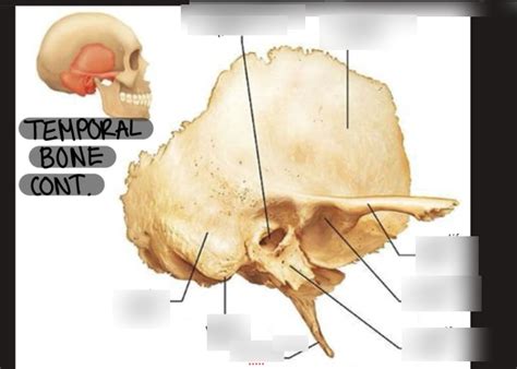 Temporal Bone Diagram Quizlet