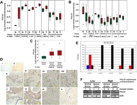 Polg1 Expression In Primary Breast Tumors Oncomine Database Analysis