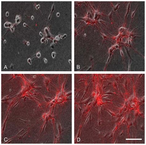 Fibroblast Cluster Formation On 3d Collagen Matrices Requires Cell Contraction Dependent