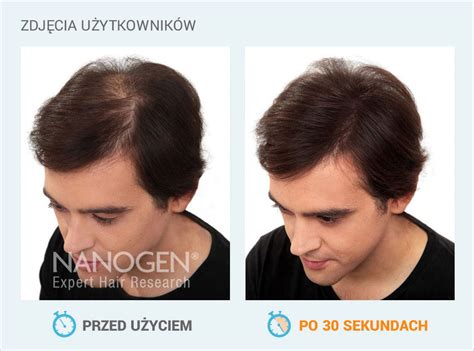 NANOGEN.PL : Innowacyjne Kosmetyki - Zagęszczanie Włosów