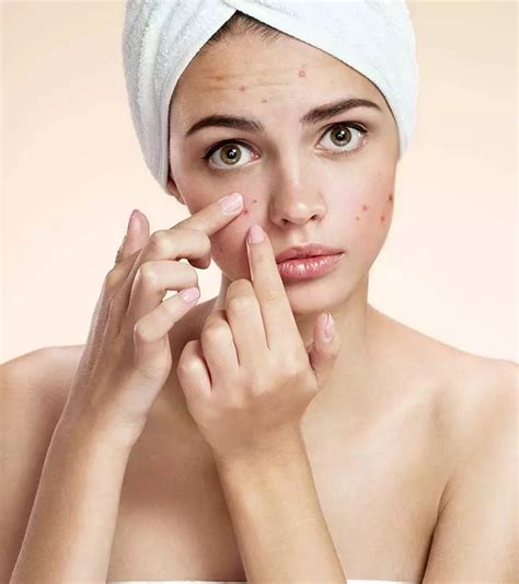 Acne Between Eyebrows Causes Treatment Prevention Tips