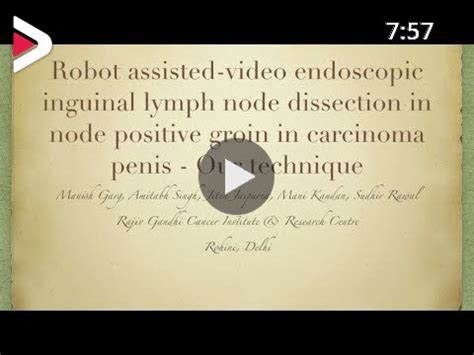 R A Video Endoscopic Inguinal Lymph Node Dissection In Node Positive Groin Of Carcinoma Penis