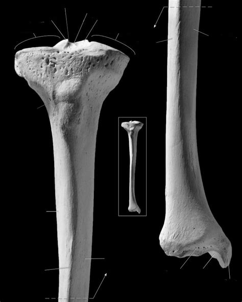 Tibia Features Part 1 Diagram Quizlet Tibia Features Part 1 Diagram Quizlet