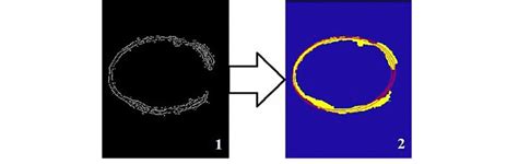 1 Canny Edge Detector Result 2 Hough Transform Result Download Scientific Diagram