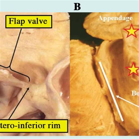 Structure Of The Left Atrium Download Scientific Diagram