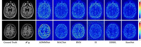 Figure 6 From Siamese Cooperative Learning For Unsupervised Image Reconstruction From Incomplete