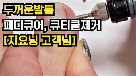 두꺼운발톱 스케일링 페디큐어 큐티클제거 Youtube