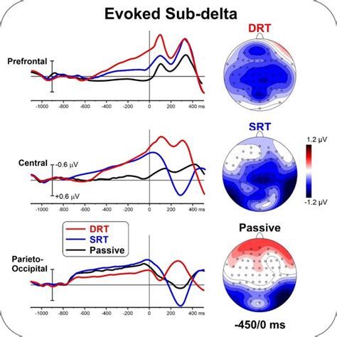 The Left Panel Shows The Overlapping Evoked Tse Waveforms In The