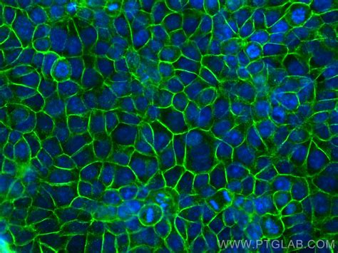 E Cadherin Antibody 31515 1 Ap Proteintech