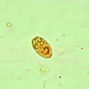 Giardia Cyst Wet Smear Stained With Iodine Source Download