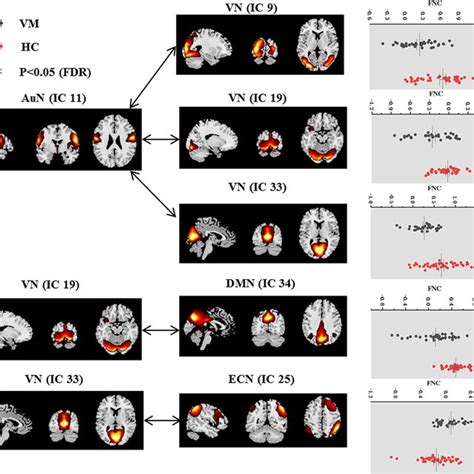 Functional Network Connectivity Fnc Significantly Related To Patients