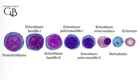 Armando Gb 🩸🔬clasificaciÓn General De Las Anemias Con Base En El Vcm Y La Chcm🔬🩸 Morfología
