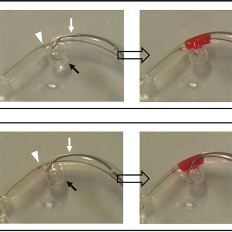 Photographs Of Experiment The Black Arrows Indicate The Aneurysm The