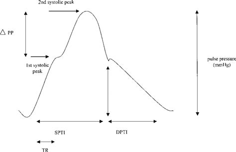 Drawing Waveform At PaintingValley Com Explore Collection Of Drawing Waveform