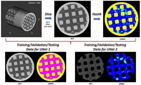 training validation testing data for the two unets labels bone dark