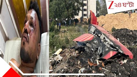 Miracle Survivor Of Ahmedabad Plane Crash অবিশ্বাস্য বিমান দুর্ঘটনার মারণ আগুন থেকে কী আশ্চর্য