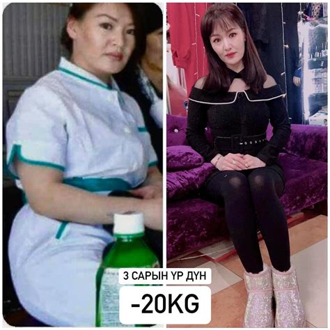 Төгөлдөр 3 сарын үр дүн Хоол сойхгүй стрессдэхгүй “ТАРАГ САХАР” ын мацгаар жаргаж илүүдлээ