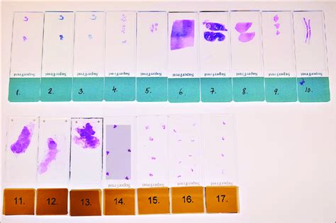 A Macroscopic View Of The Seventeen Routine Histopathological Slides Download Scientific