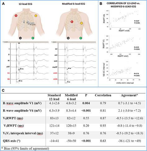 Modified Electrocardiogram Using Only Limb Leads To Record V1 And V6 A