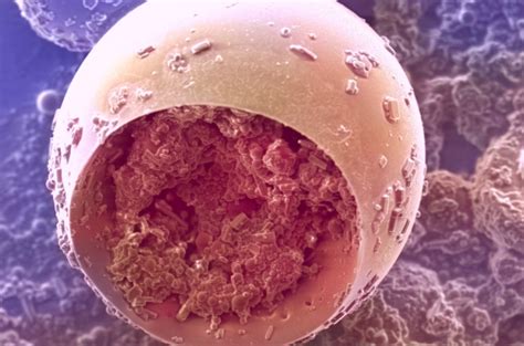 Biodegradable And Biocompatible Nano And Microparticle Development